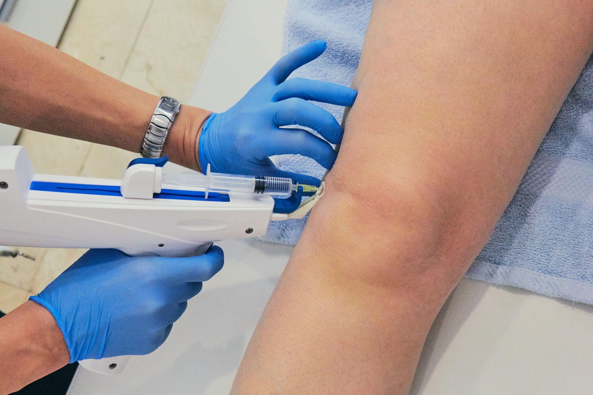 What to Expect Following ClariVein Treatment | Canada Vein Clinics